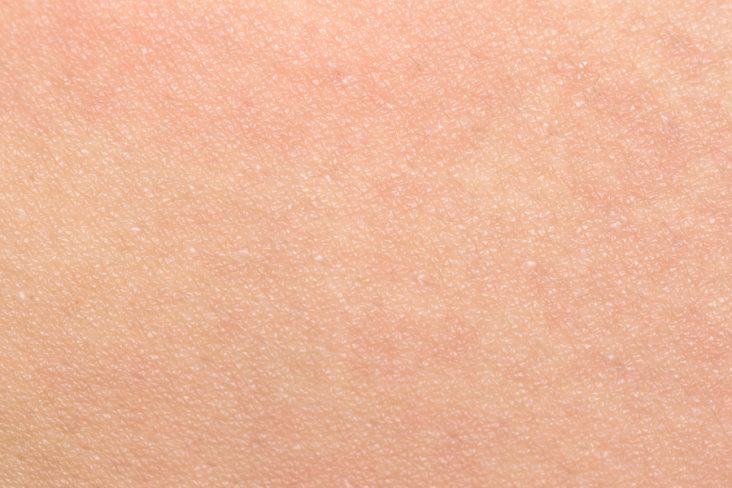 Why Are Fleas Attracted to Me? | BeatPests