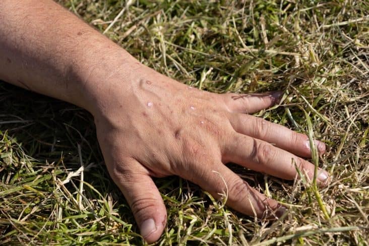 What Does a Termite Bite Look Like? | BeatPests